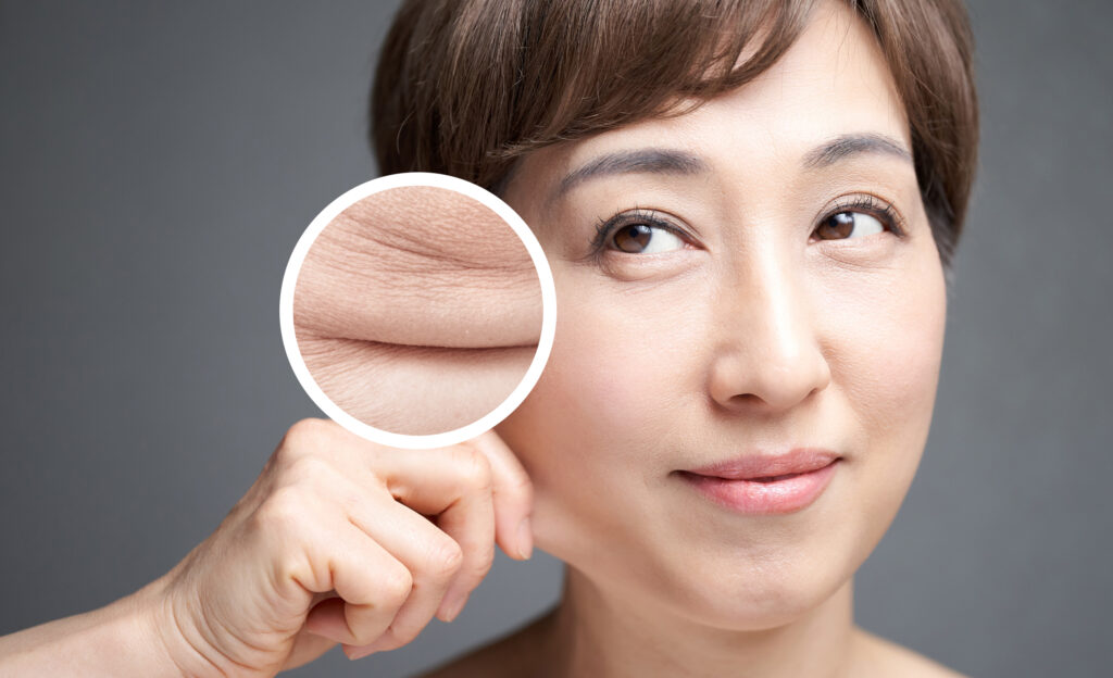 Loose Skin and Elasticity Loss - True Harmony