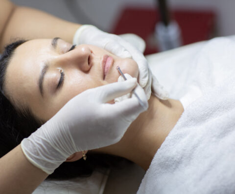 Milia Extraction | Oil Clogs Removal - True Harmony