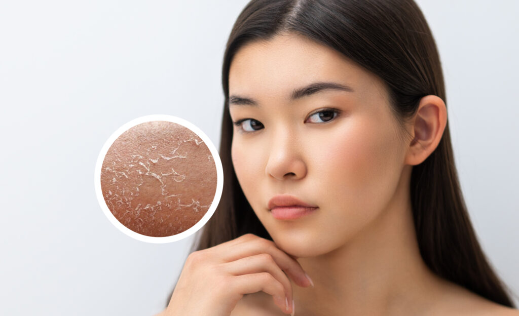 Dehydrated Skin - True Harmony