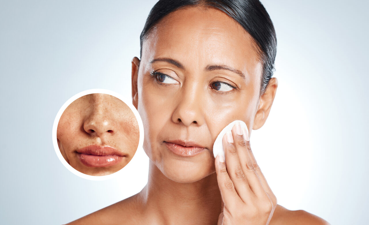 Oily Skin and pH Imbalance - True Harmony