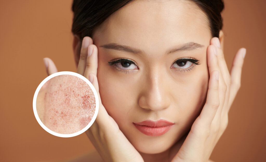 Sensitive Skin - True Harmony